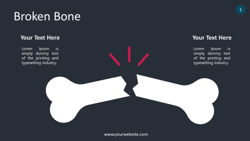 Free Fractured Bone Slides Powerpoint Template - DesignHooks
